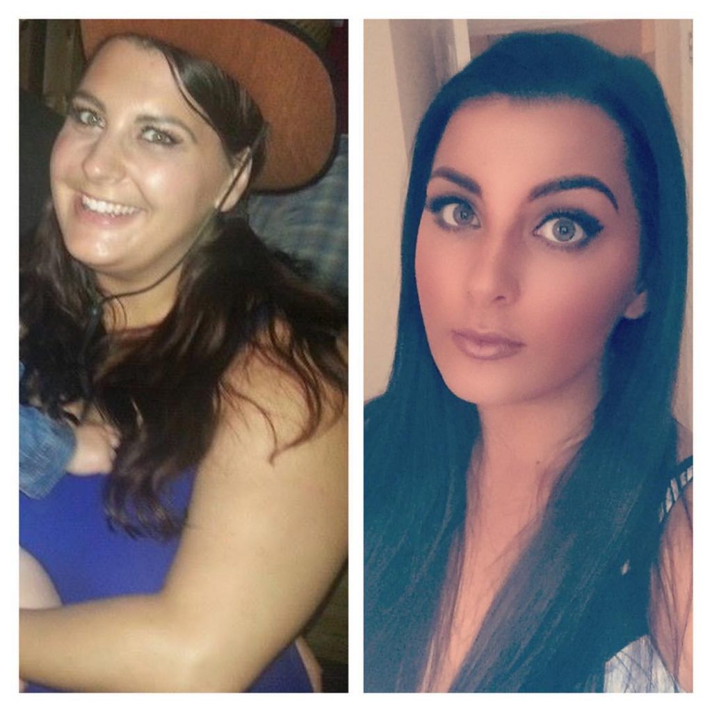 before and after success stories