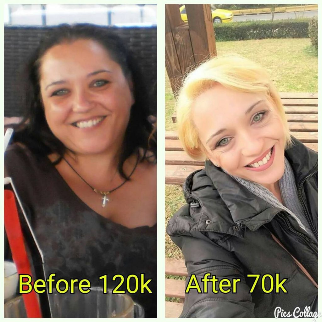 before and after weight loss success stories