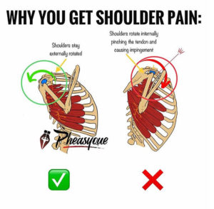 PULL UPS & SHOULDER PAIN | Guide
