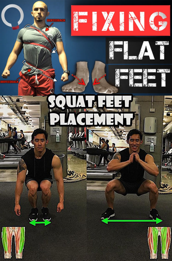 Flat Feet Correction – Training The Feet With The Core