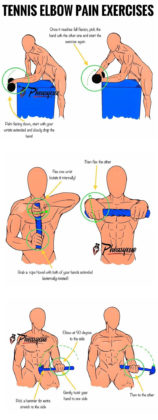 3 TENNIS ELBOW EXERCISES