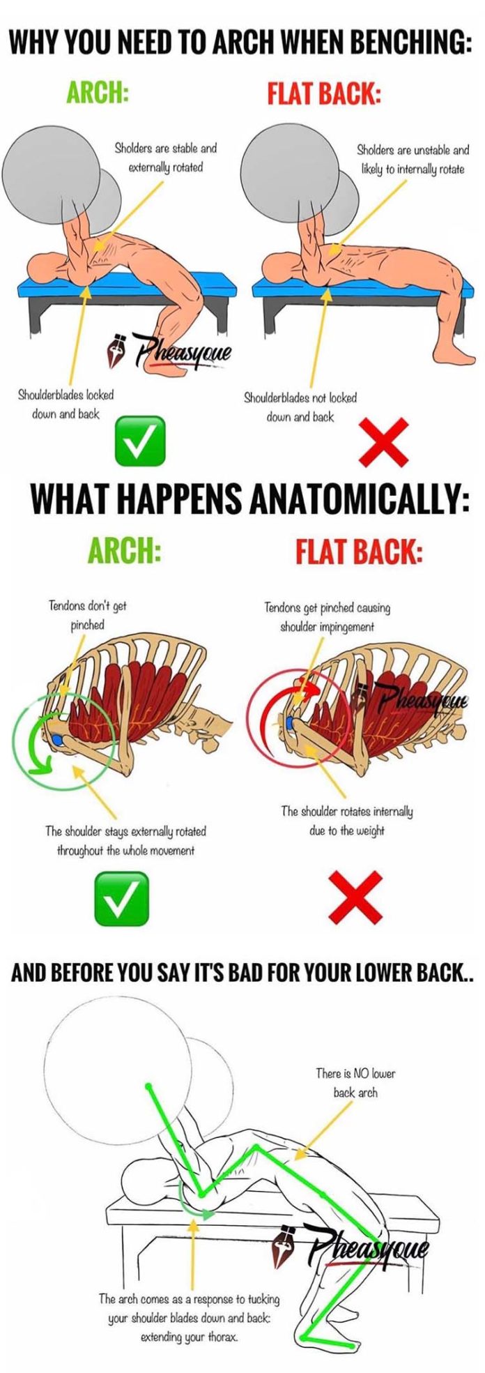 WHY THE BENCH ARCH IS ACTUALLY NECESSARY